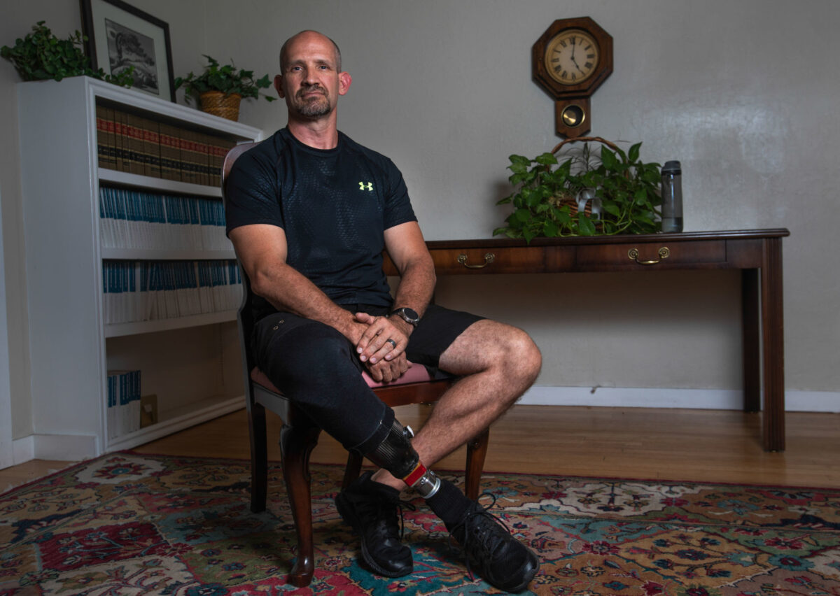 Man loses leg in construction zone crash, now makes prosthetics for ...